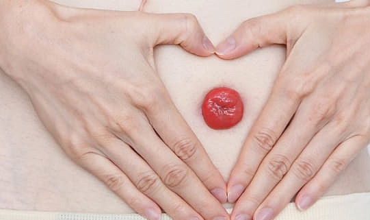 Comprehensive Stoma Care: Keeping Your Skin Healthy and Problem-Free ...